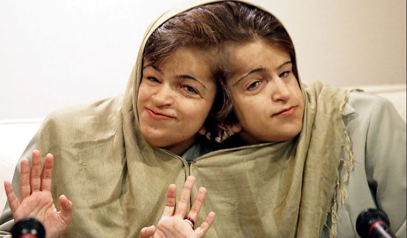 Ladan and Laleh Bijani’s story – Tewnet.com